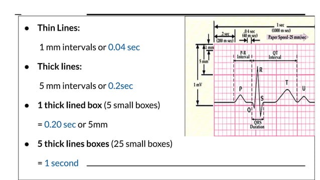 Types of heart blocks with it's ecg variations | PPT