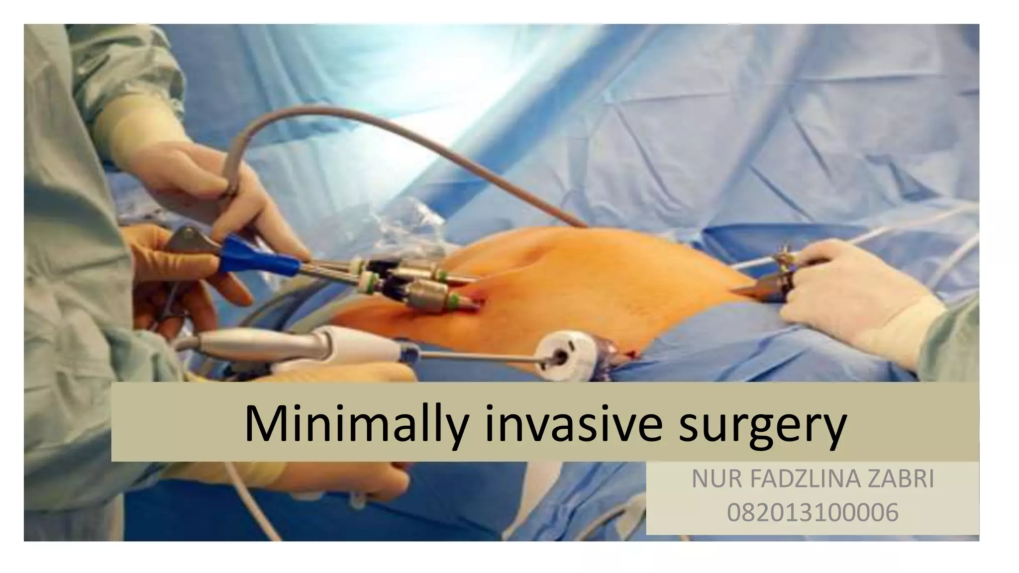 Minimally invasive surgery | PPTX