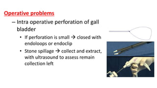 Minimally invasive surgery | PPTX