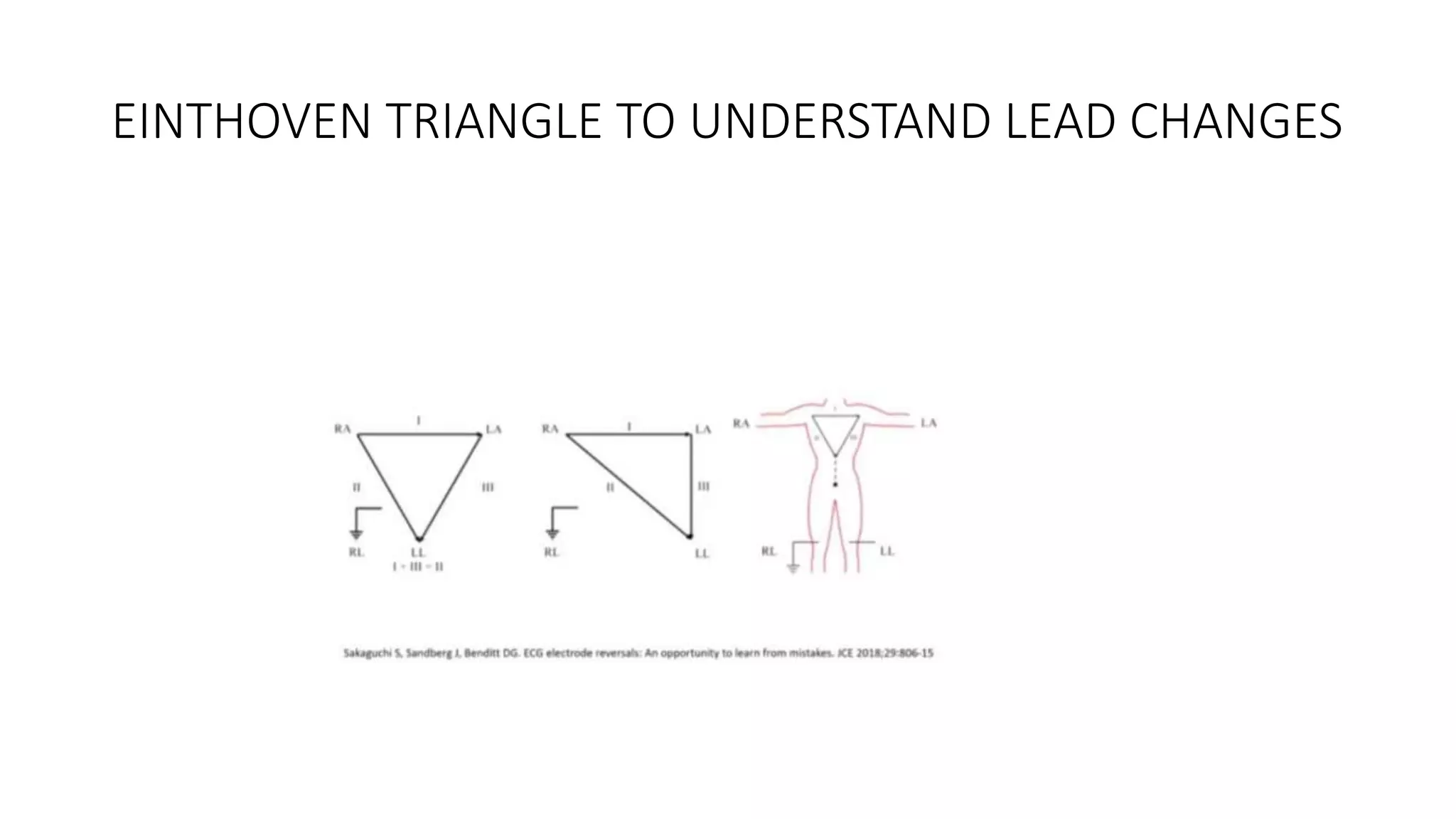 MISPLACED ECG LEADS.pptx