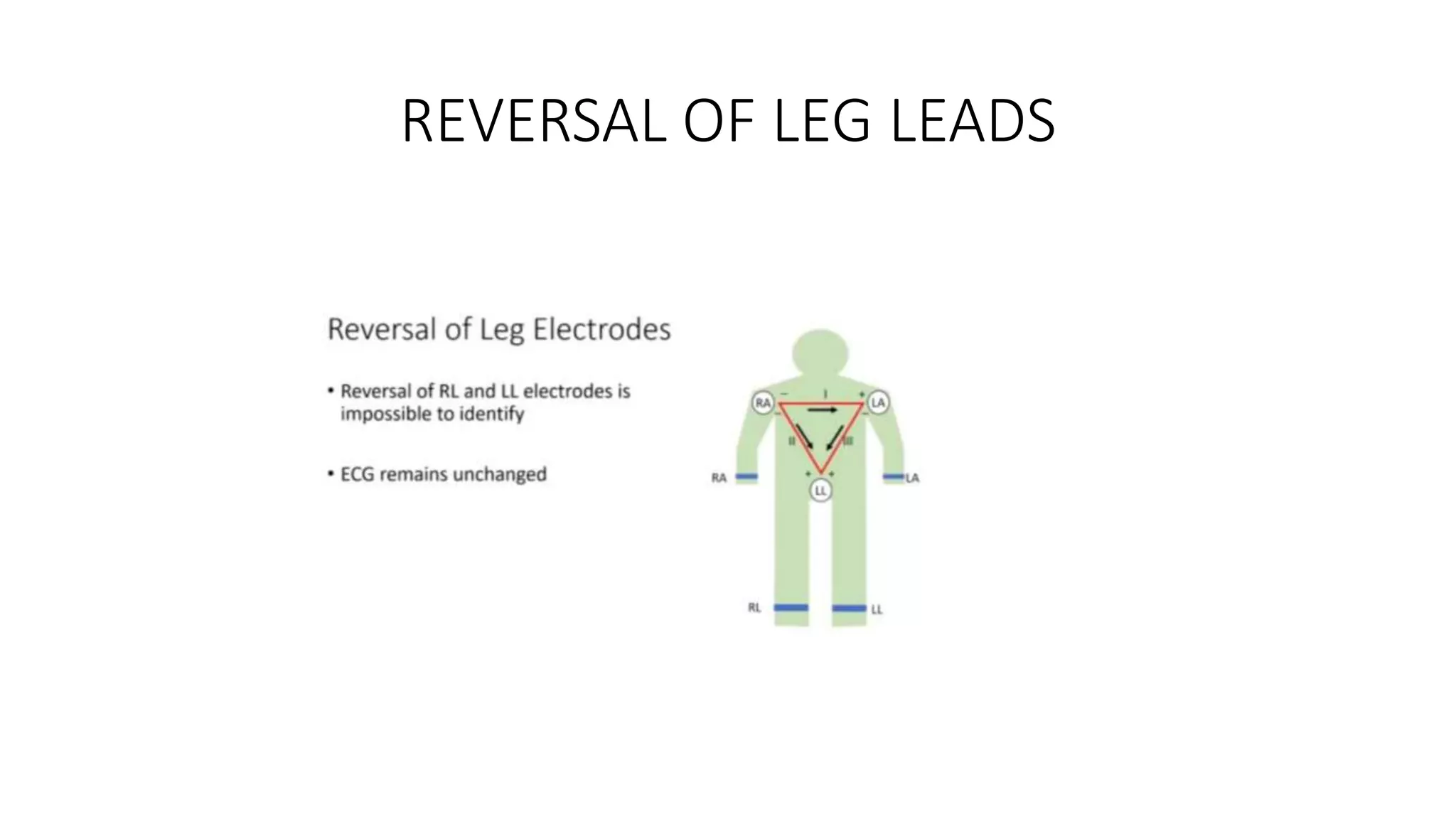 MISPLACED ECG LEADS.pptx