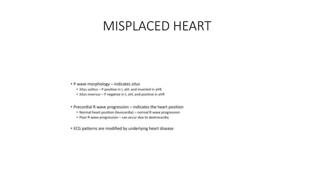 MISPLACED ECG LEADS.pptx