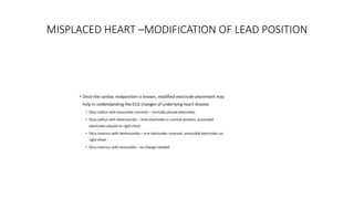 MISPLACED ECG LEADS.pptx