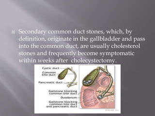 Common Bile Duct Stone