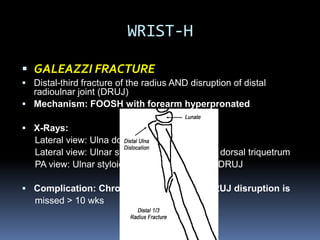 Missed fractures in Emergency Department | PPTX