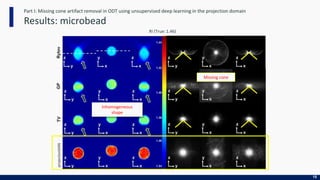 Missing cone artifact removal in odt using unsupervised deep learning ...