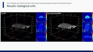 Missing cone artifact removal in odt using unsupervised deep learning ...