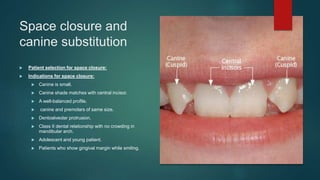 Missing maxillary lateral incisor | PPTX