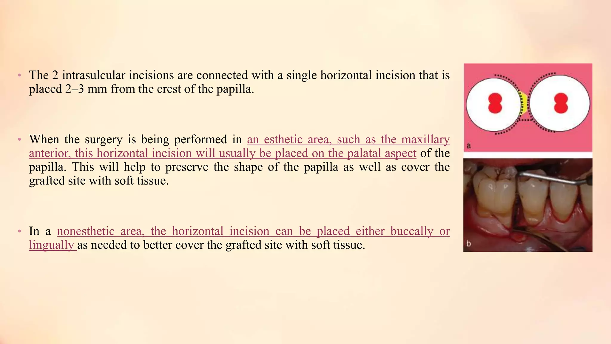 Minimally invasive surgical techniques in periodontics | PPTX