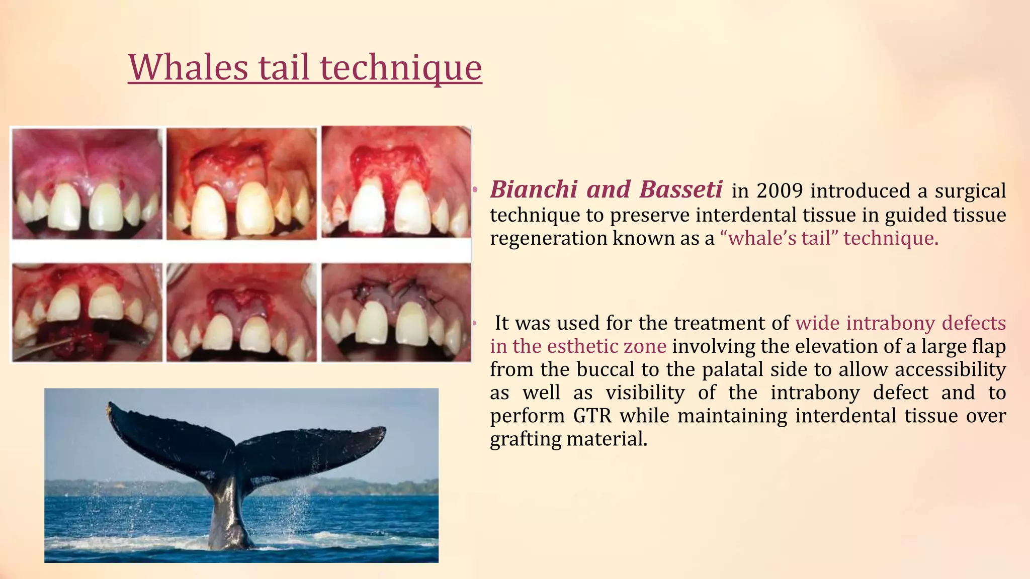 Minimally invasive surgical techniques in periodontics | PPTX