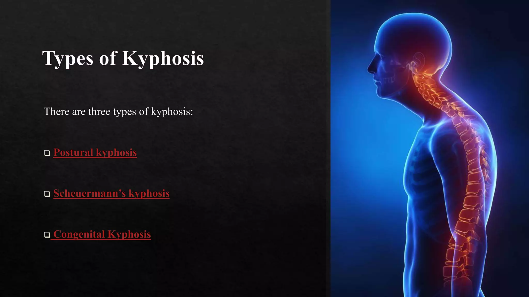 Scoliosis and kyphosis.pptx