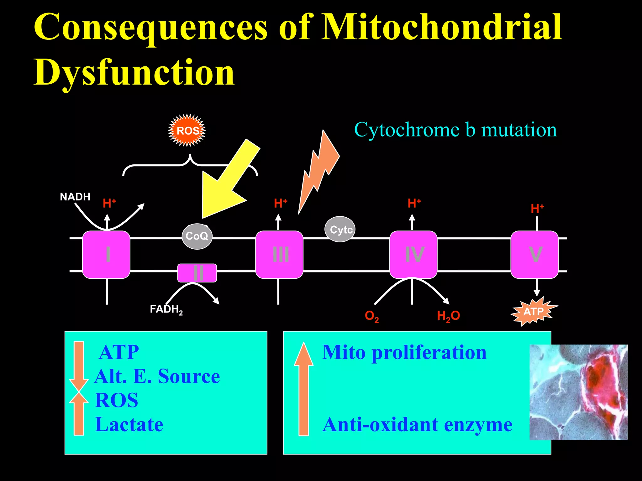 Exercise and nutrition in Mitochondrial Disease | PDF