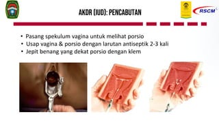 Mitos dan Fakta AKDR Mitos dan Fakta AKDR | PPT