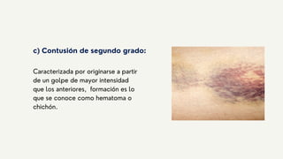 Mitos del cuidado personal Atencion de primeros auxilios en heridas y ...