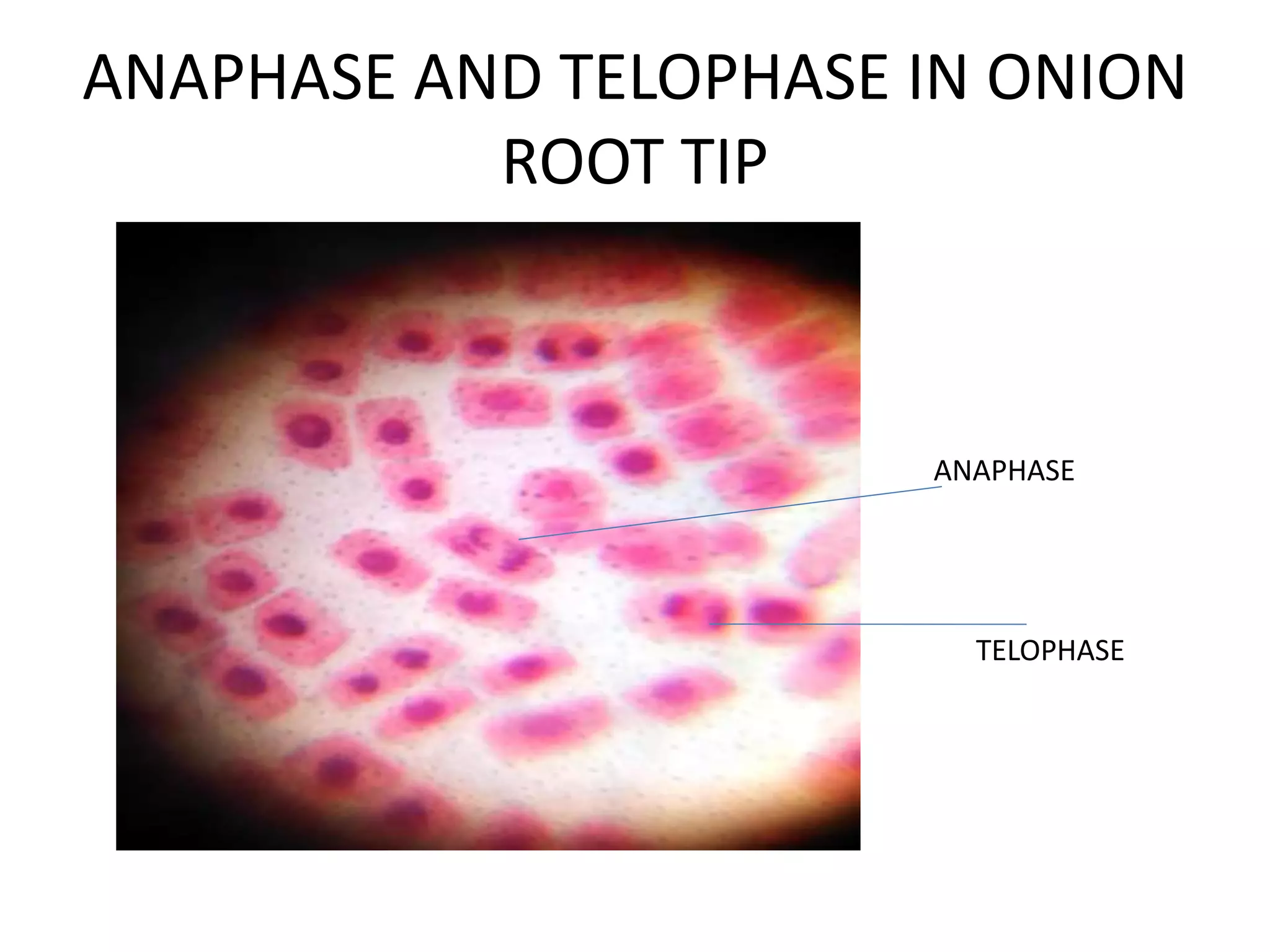 STAGES OF MITOSIS IN ONION ROOT TIP | PPTX