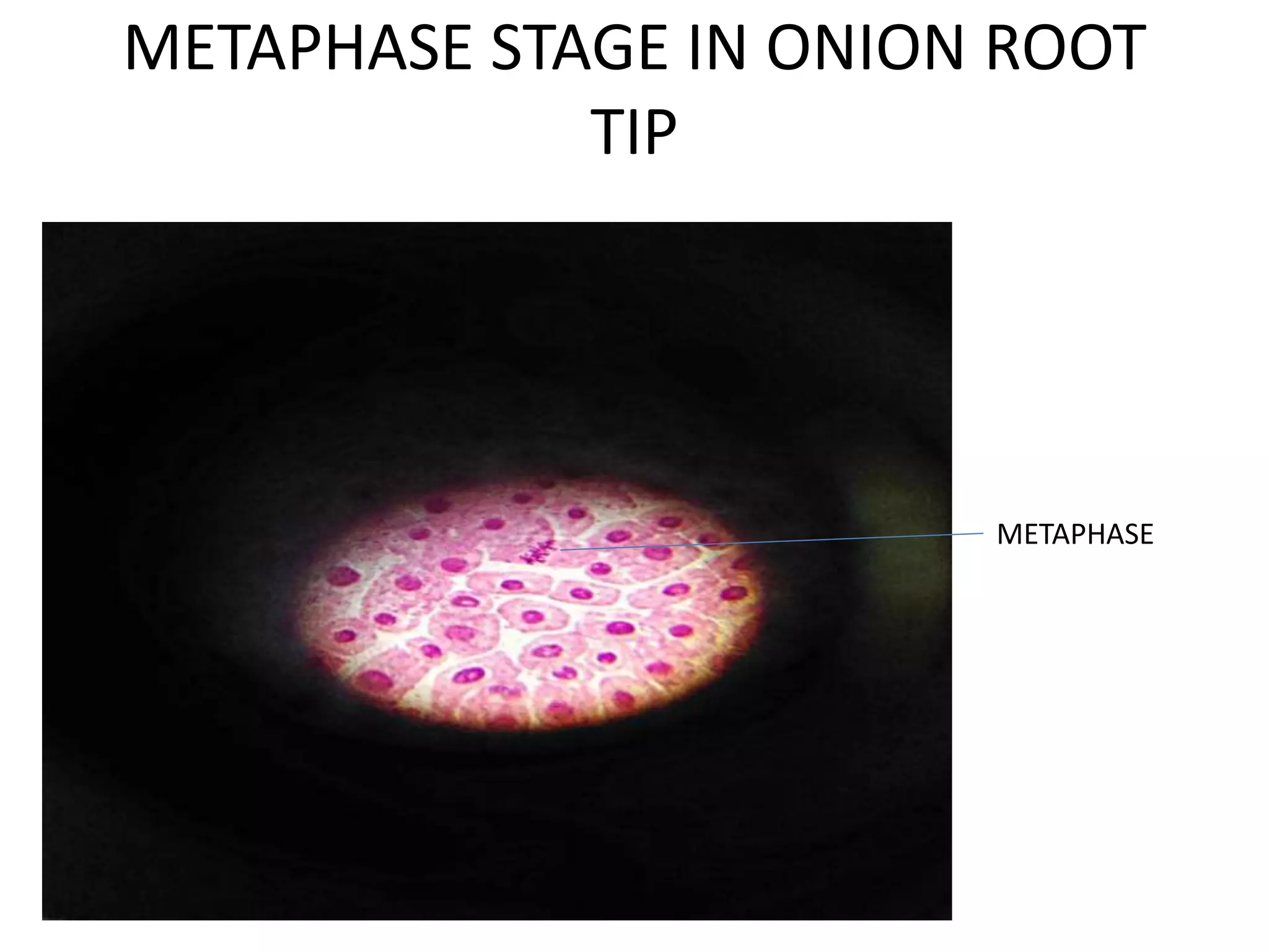 STAGES OF MITOSIS IN ONION ROOT TIP | PPT