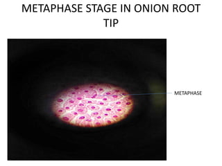 Stages Of Mitosis In Onion Root Tip