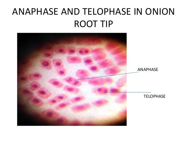 Telophase Onion Root Tip