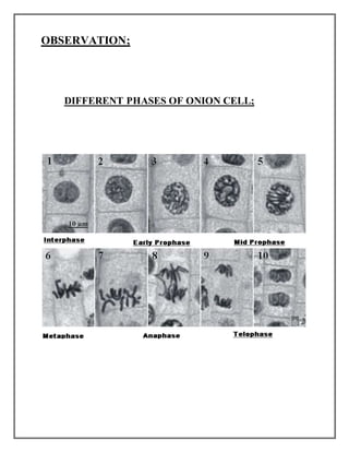 Onion Cell Mitosis Worksheet