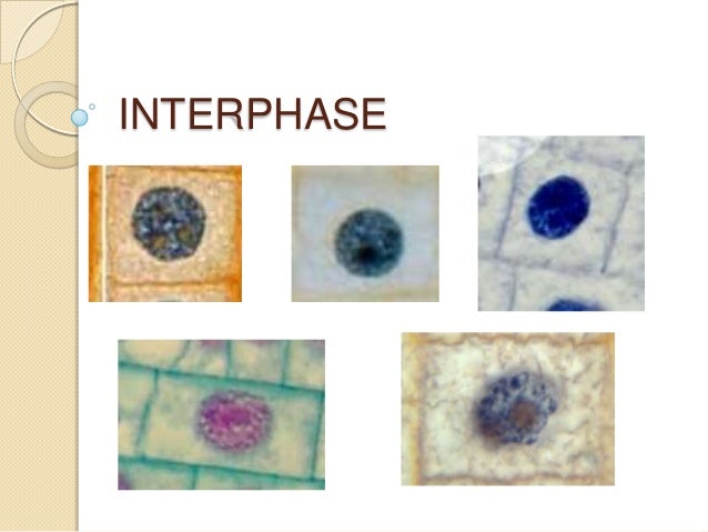 Mitosis Lab Onion Root Tip mitosis-lab-onion-root-tip