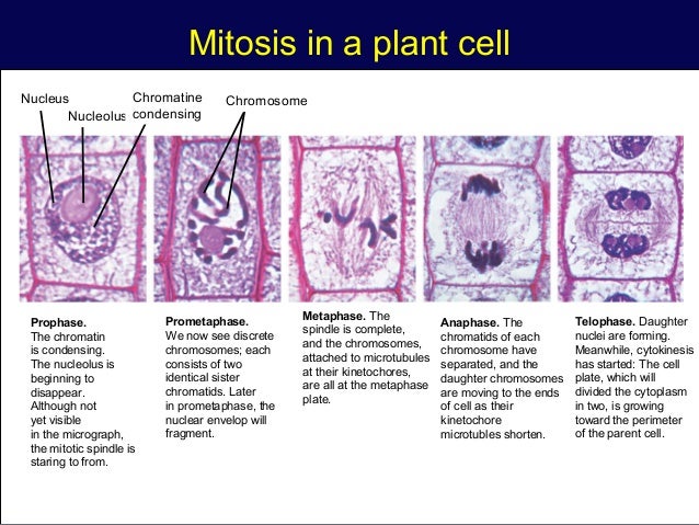 Prophase under microscope - supersalo