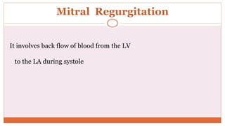 Mitral | PPTX