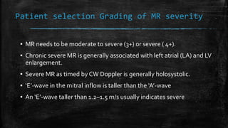 Mitral clip (Dr.Azam) | PPTX