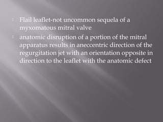 Mitral regurgitation | PPT