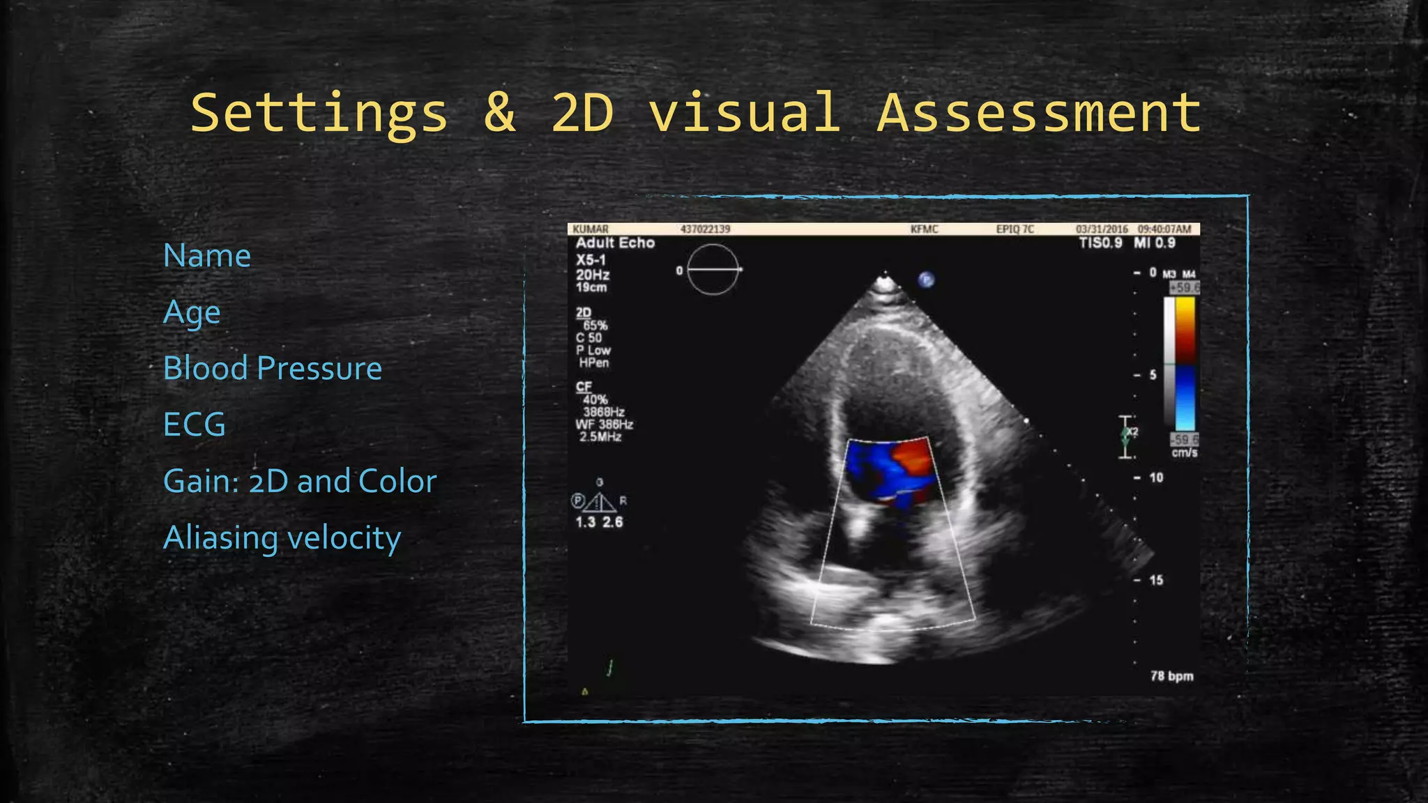 Echocardiography of Mitral regurgitation | PPTX