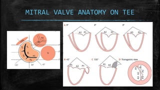 Echocardiography of Mitral regurgitation | PPTX