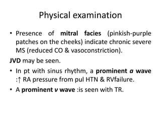 Mitral Facies