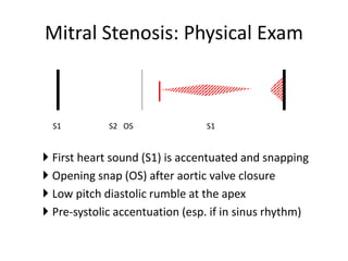 Mitral stenosis | PPTX