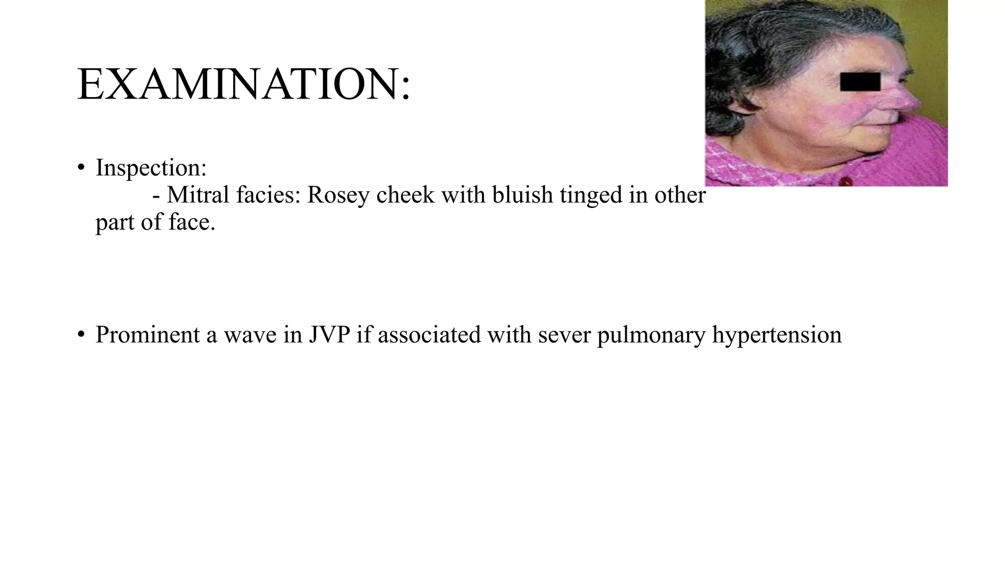 Mitral stenosis.pptx