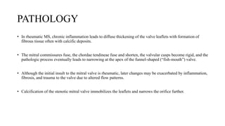 Mitral stenosis.pptx