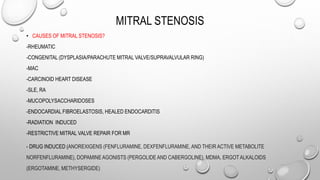 Mitral stenosis.pdf