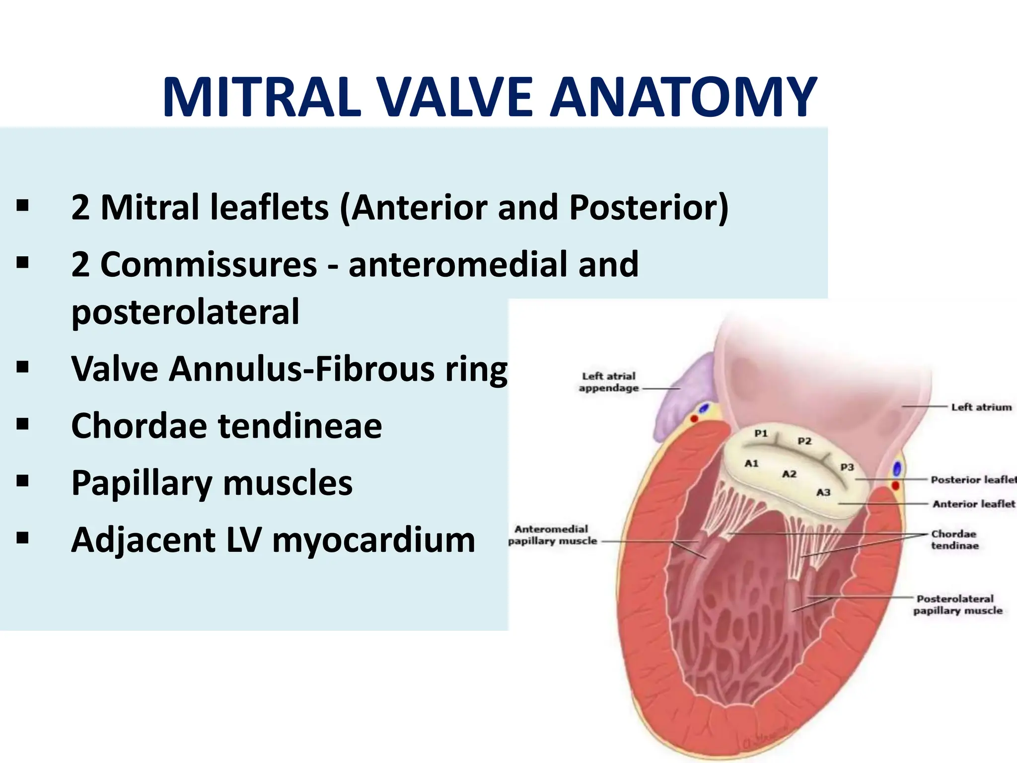 MITRAL STENOSIS - UG Final by Dr JTR.pptx