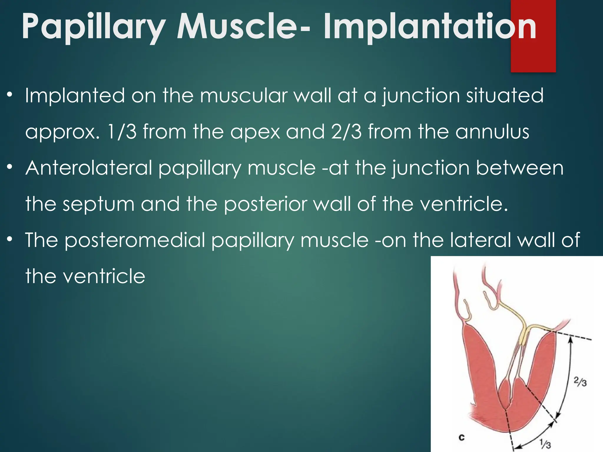 Mitral Stenosis- Pathophysiology, diagnosis and management | PPTX