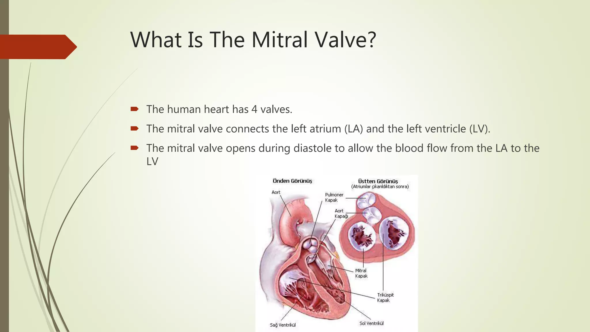 Mitral valve | PPTX