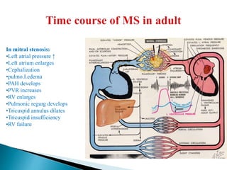 Mitral valve disease | PPTX