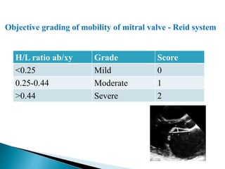 Mitral valve disease | PPTX