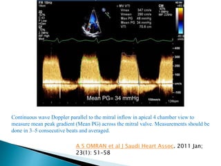 Mitral valve disease | PPTX