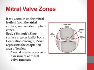 Mitral valve anatomy.pptx