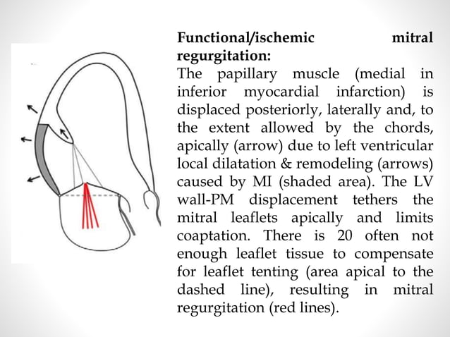 Mitral valve anatomy.pptx | Heart and Cardiovascular Diseases ...