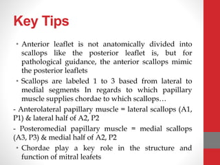 Mitral valve anatomy.pptx