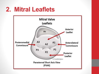 Mitral valve anatomy.pptx