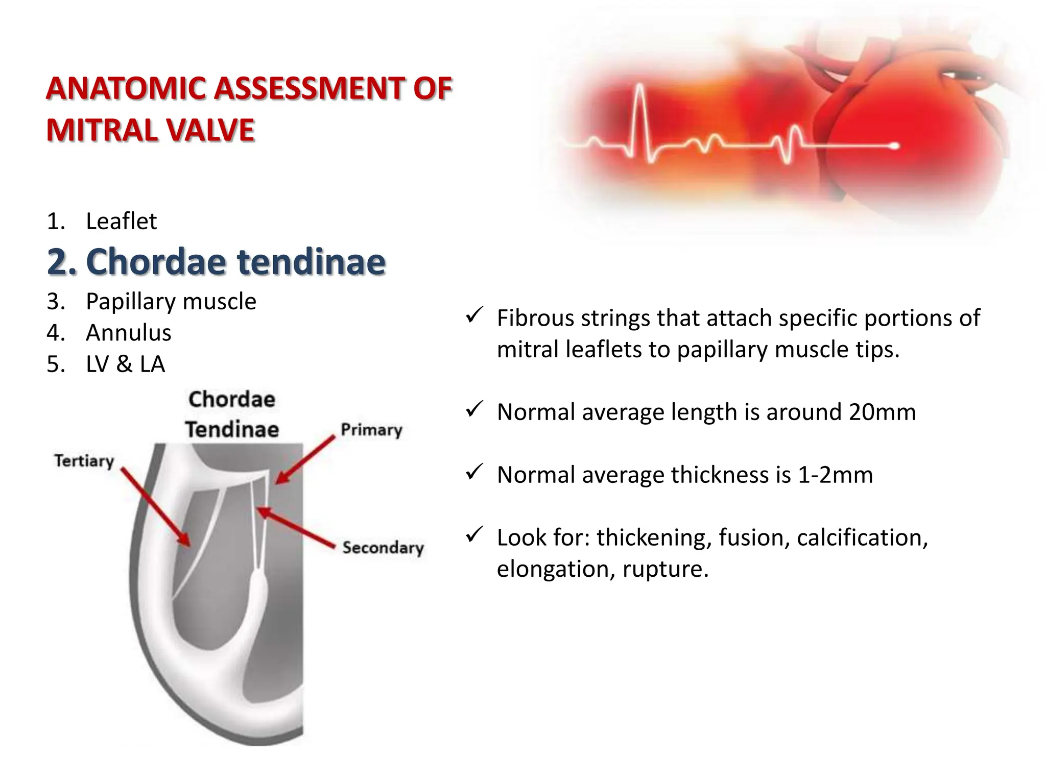 MITRAL VALVE ASSESSMENT ECHO 11.04.24.pptx
