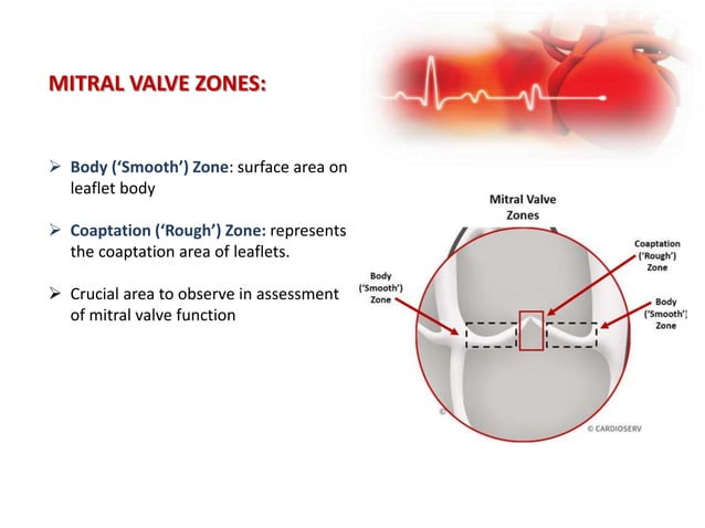 MITRAL VALVE ASSESSMENT ECHO 11.04.24.pptx | Heart and Cardiovascular ...