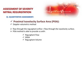 MITRAL VALVE ASSESSMENT ECHO 11.04.24.pptx | Heart and Cardiovascular ...