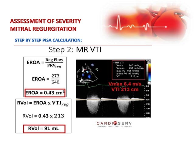 MITRAL VALVE ASSESSMENT ECHO 11.04.24.pptx | Heart and Cardiovascular ...
