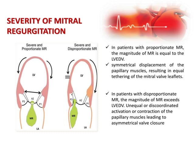 MITRAL VALVE ASSESSMENT ECHO 11.04.24.pptx | Heart and Cardiovascular ...